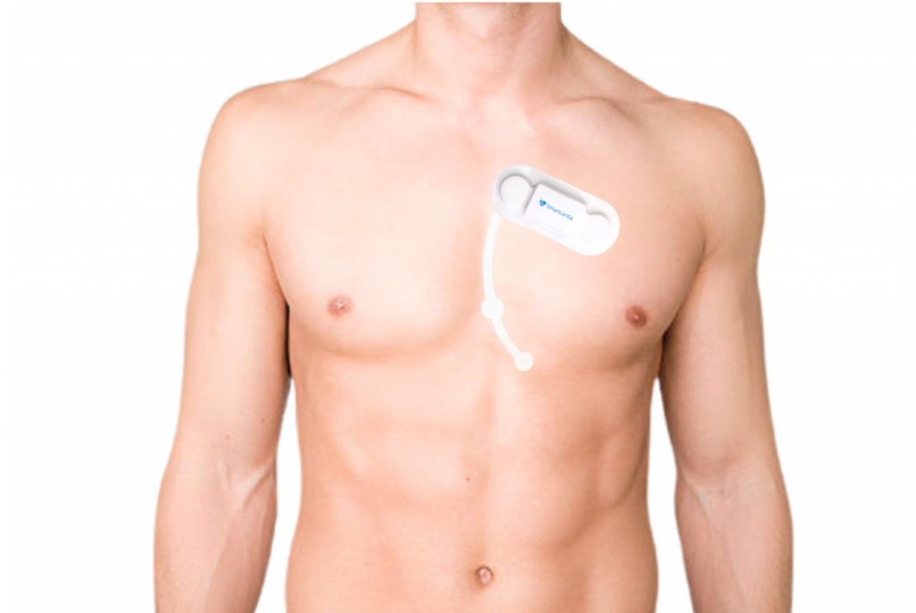 Los parches permiten realizar electrocardiogramas a distancia